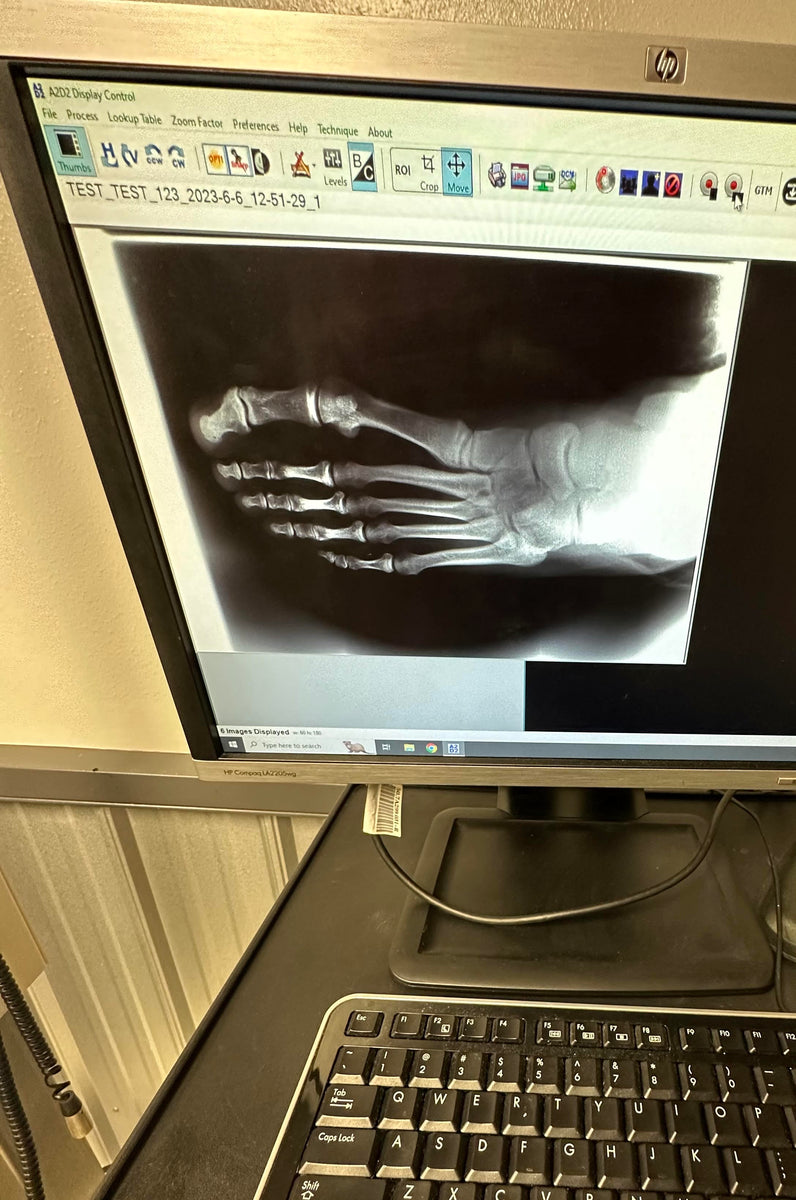 Digital Podiatry X-Ray System (Preowned) – Saumell Medical Supplies